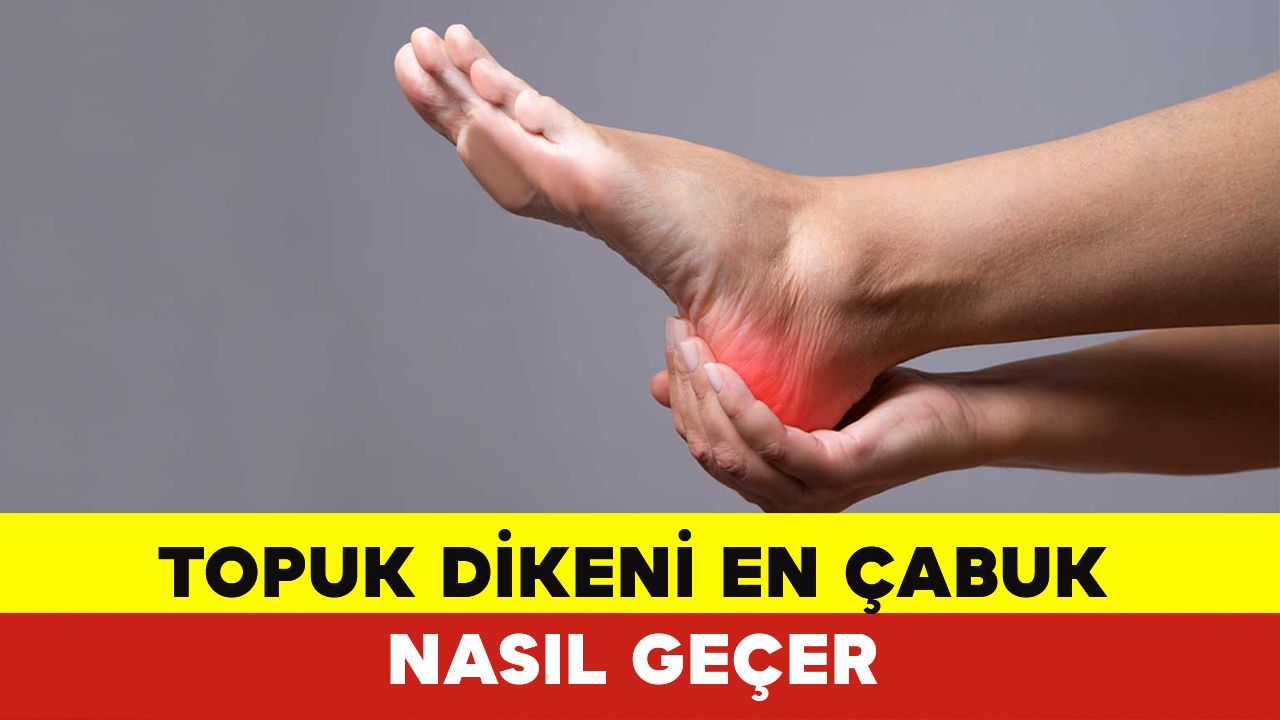 Topuk Dikeni En Çabuk Nasıl Geçer? Topuk Dikeni En Çabuk Nasıl Geçer?