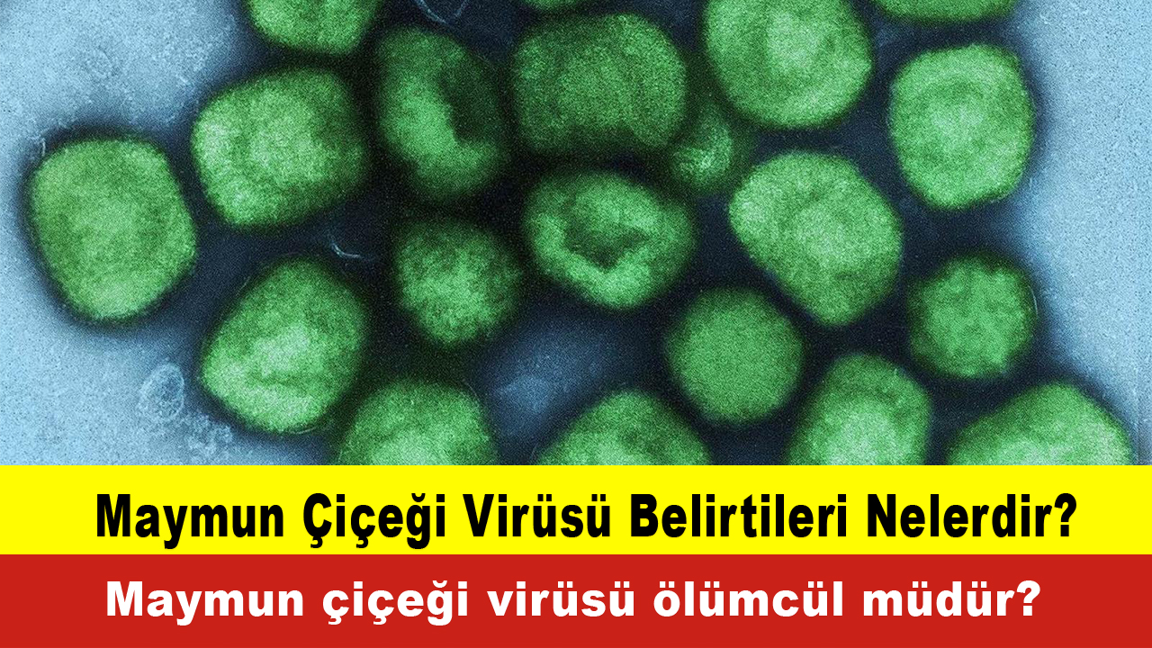 Maymun Çiçeği Virüsü Belirtileri Nelerdir?